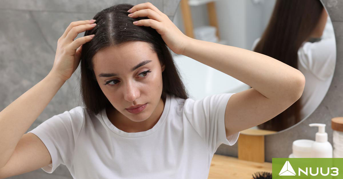Scalp Eczema: Causes, Symptoms, and Effective Treatments – Nuu3